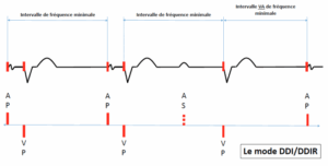 Pacemaker Pacing Modes: VVI, DDD, AAI, DDDR Explained | Cardiocases