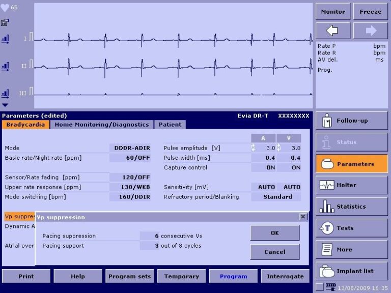 Biotronik Pacemaker Pacing Modes | DDD VVI | Cardiocases